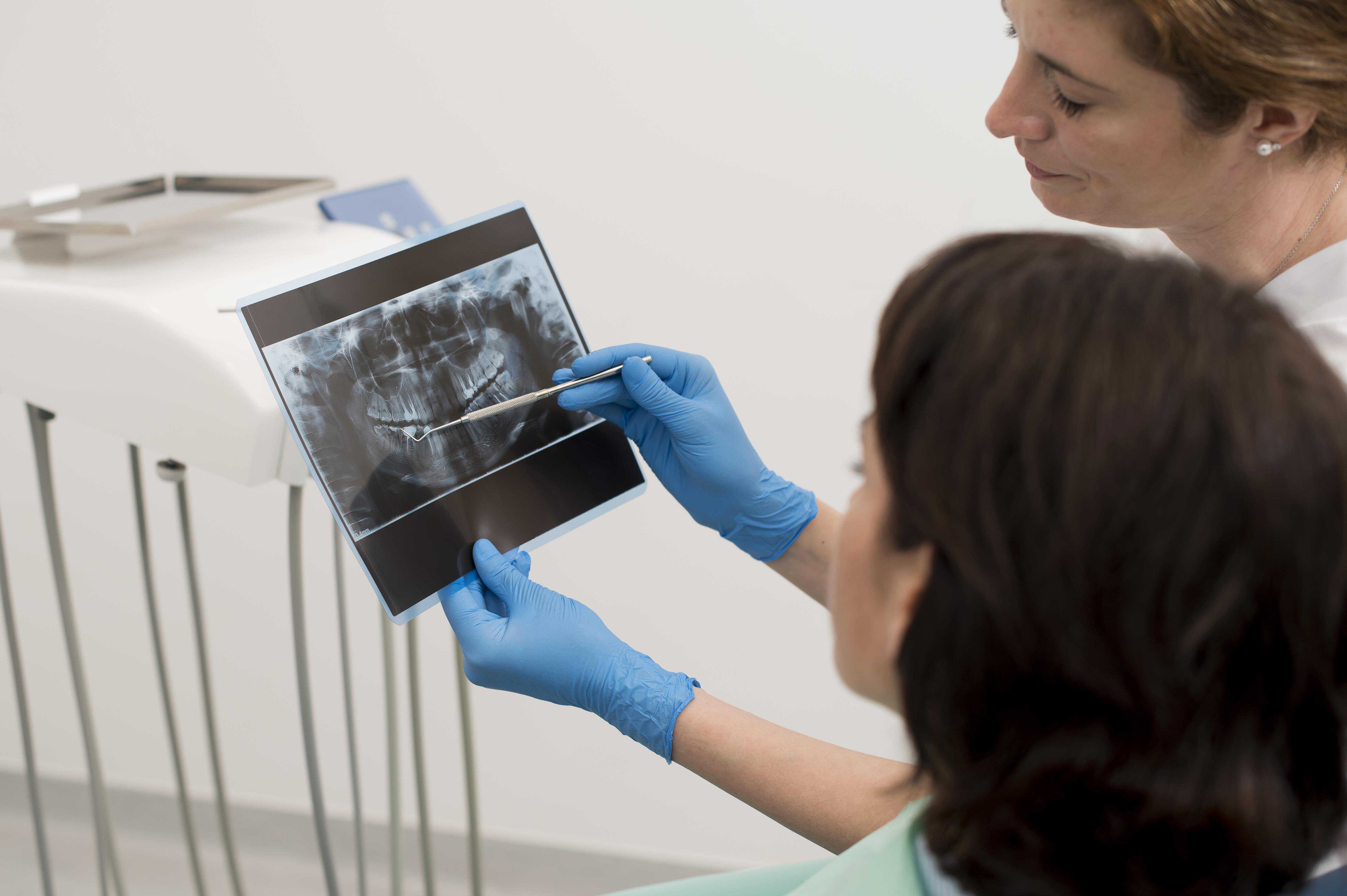 Exploring Dental Imaging: An In-depth Look at X-Rays